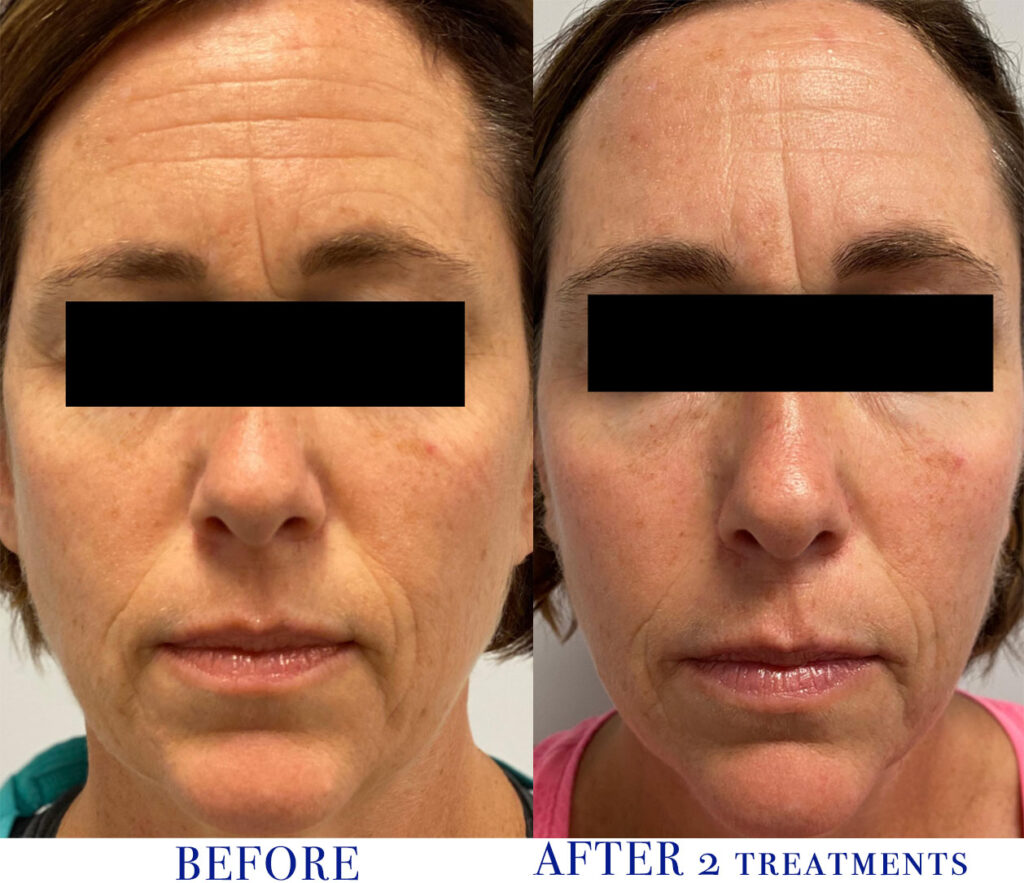 MICROCURRENT TREATMENT – GINAMARIE Products | Skin Care & Cosmetics